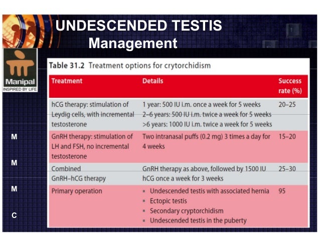 Cryptorchidism Undescended Testis