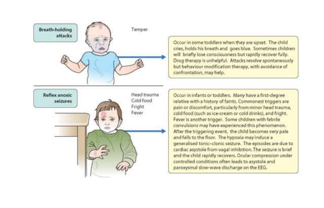 Child with convulsion | PPTX | Brain and Nervous System Disorders ...