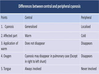 Child with cyanosis | PPTX