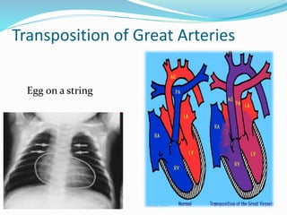 Child with cyanosis | PPTX