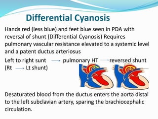 Differential Cyanosis