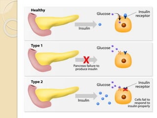 Child with enendocrine disorders | PPTX