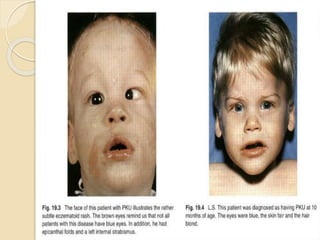 Child with enendocrine disorders | PPTX