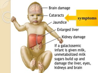 Child with enendocrine disorders | PPTX