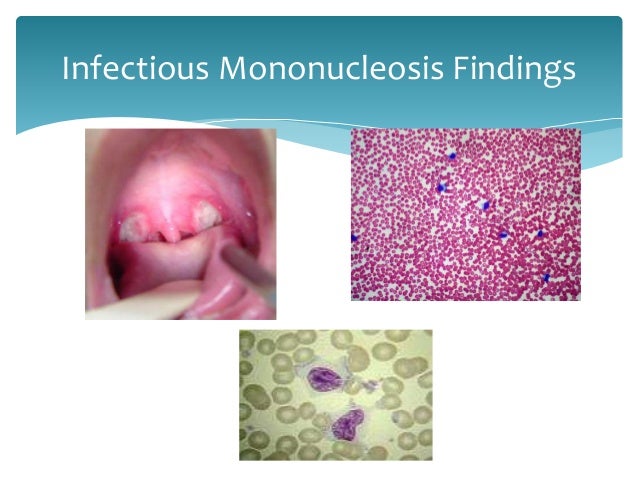 Child with lymphadenopathy