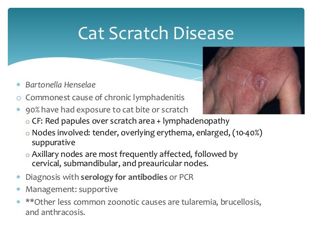 Cat Scratch Disease Rash