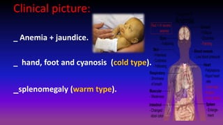 Child with pallor & jaundice (hemolytic anemia) | PPT