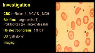Child with pallor & jaundice (hemolytic anemia) | PPTX