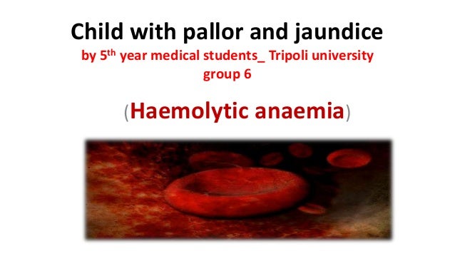 Child with pallor & jaundice (hemolytic anemia)