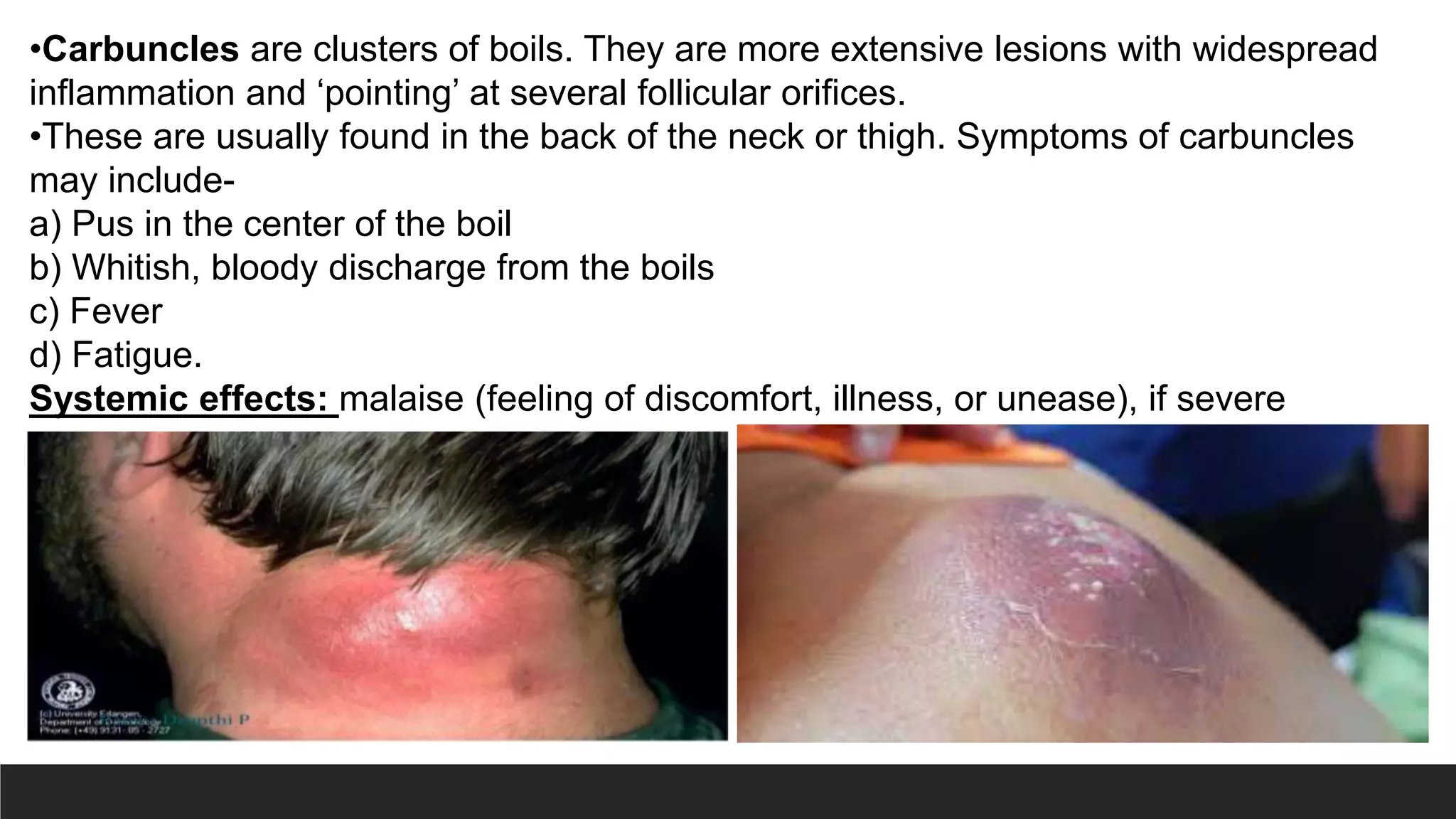 Child with skin disorder | PPTX