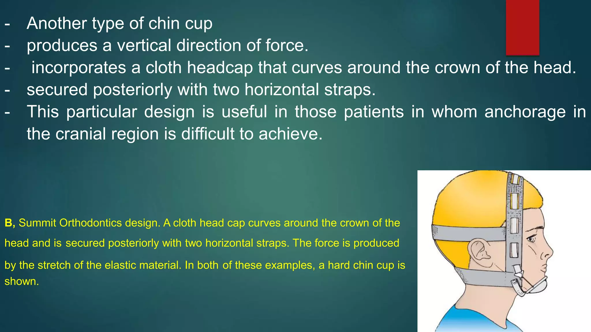 Chin cup for treatment of growing class III patient | PPTX