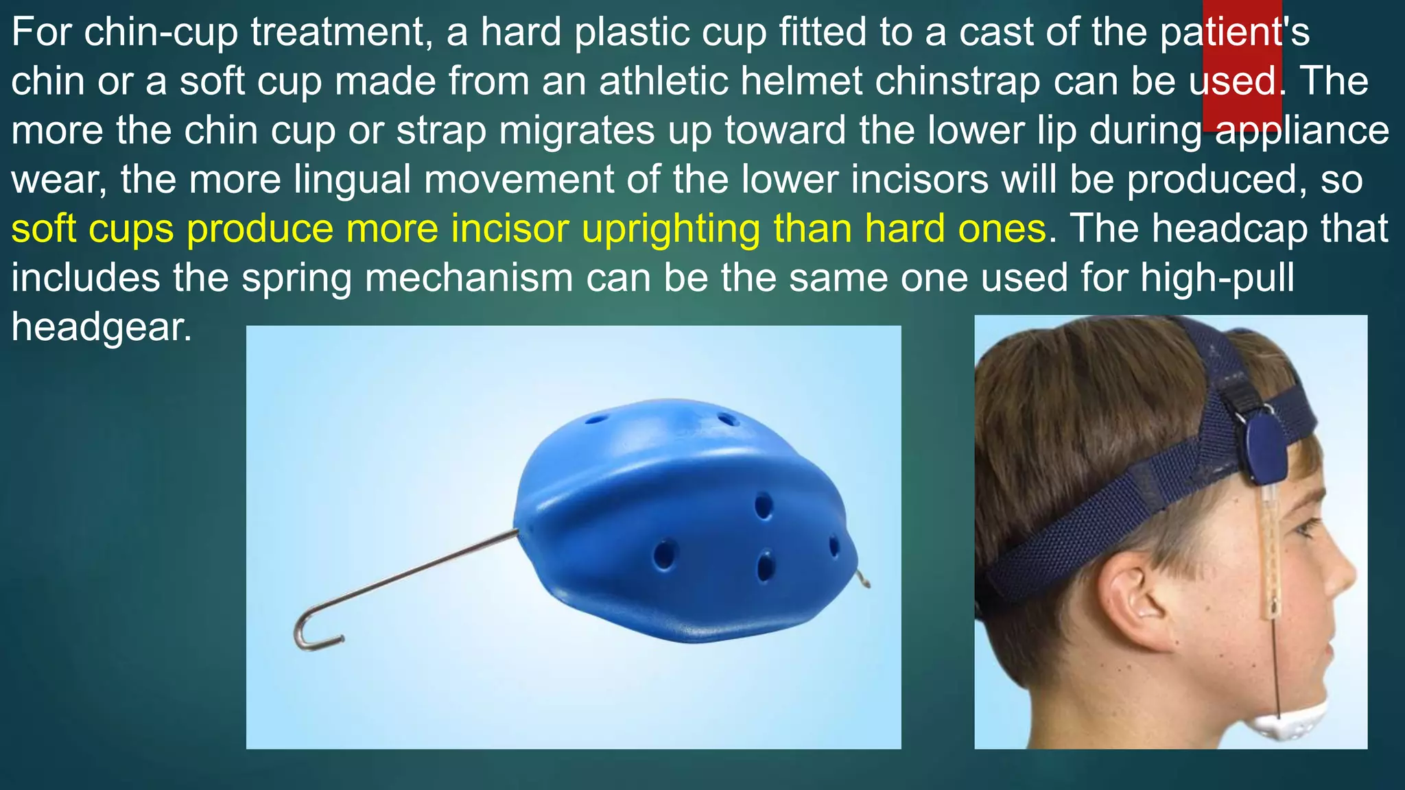 Chin cup for treatment of growing class III patient | PPTX