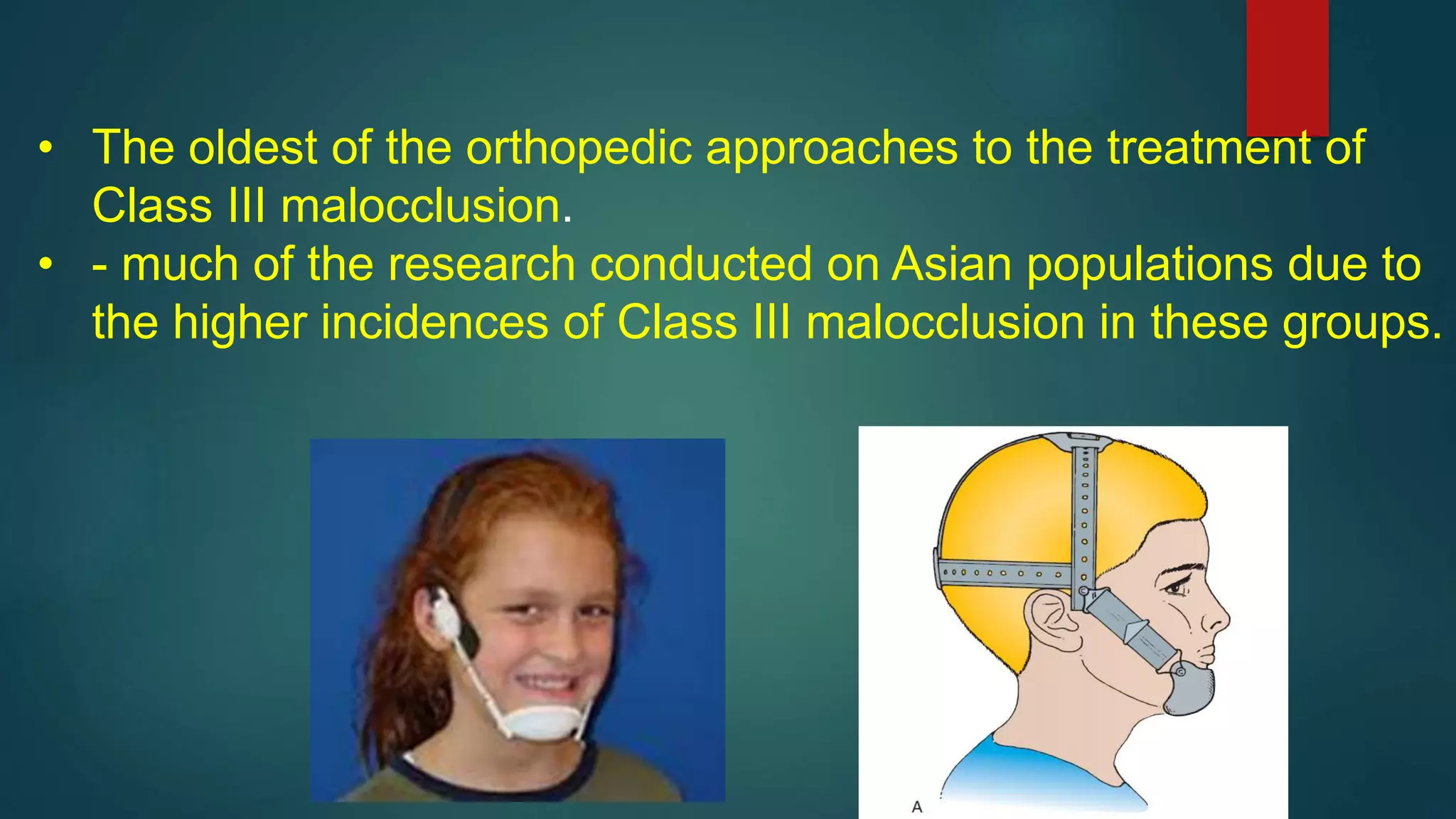 Chin cup for treatment of growing class III patient | PPTX
