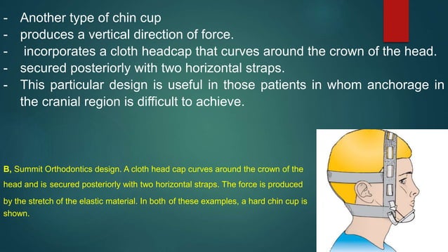 Chin cup for treatment of growing class III patient | PPTX
