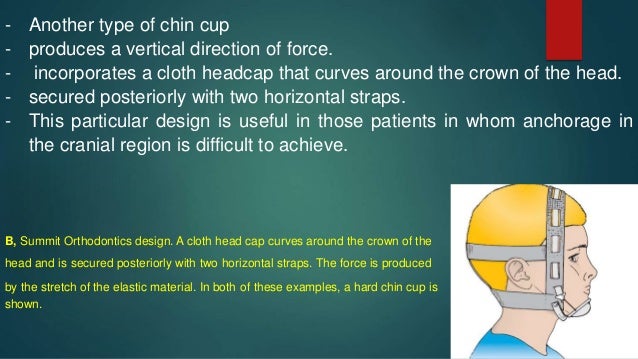 Chin cup for treatment of growing class III patient