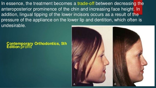 Chin cup for treatment of growing class III patient