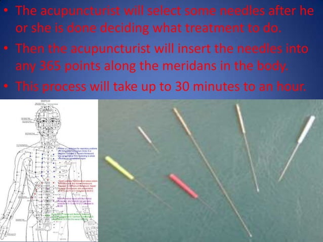 Chinese culture acupuncture | PPT