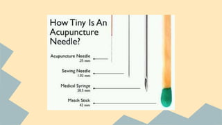 Chinese Acupuncture presentation | PPT
