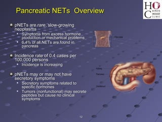 Pancreatic neuroendocrine tumours | PPT