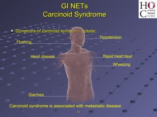 Carcinoid Syndrome Rash