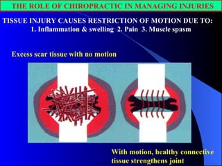 Chiropractic And Injury | PPT