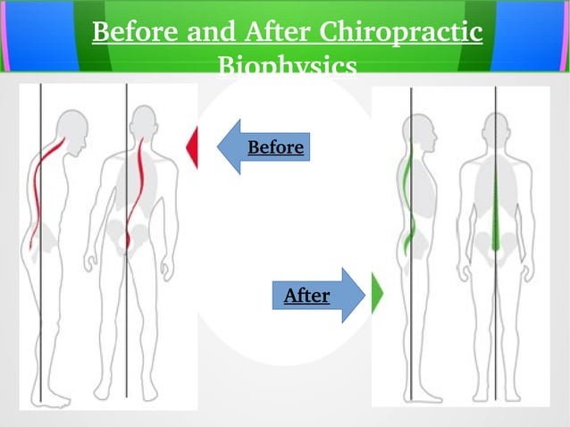 Chiropractic biophysics | PPT | Medical Tests | Medical Health