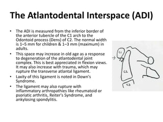 Chiropractic line analysis | PPTX