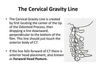 Chiropractic line analysis | PPTX