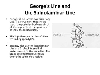 Chiropractic line analysis | PPTX