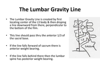 Chiropractic line analysis | PPTX