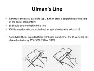 Chiropractic line analysis | PPTX