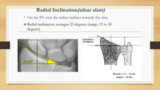 distal radius # ppt | PPTX | Death, Injury, or Military Conflict ...