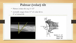 distal radius # ppt | PPTX