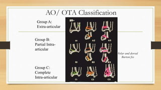 distal radius # ppt | PPTX