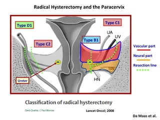 Chirurgia laparoscopica in ginecologia oncologica | PPT