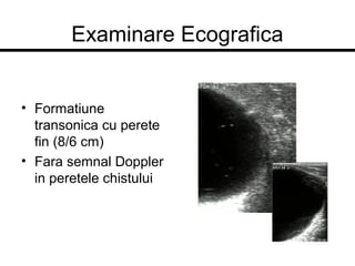 Chist hidatic axilar | PPT