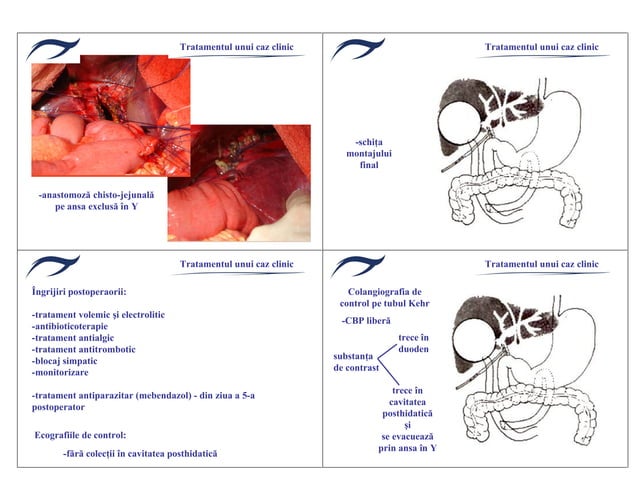 chist pulmonar.pdf