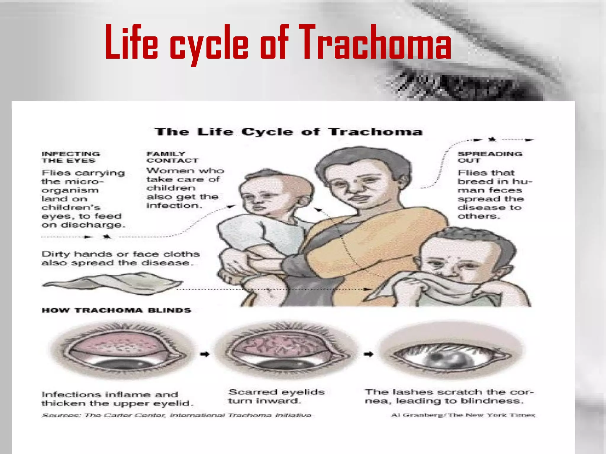 Chlamydia Conjunctivitis Ppt