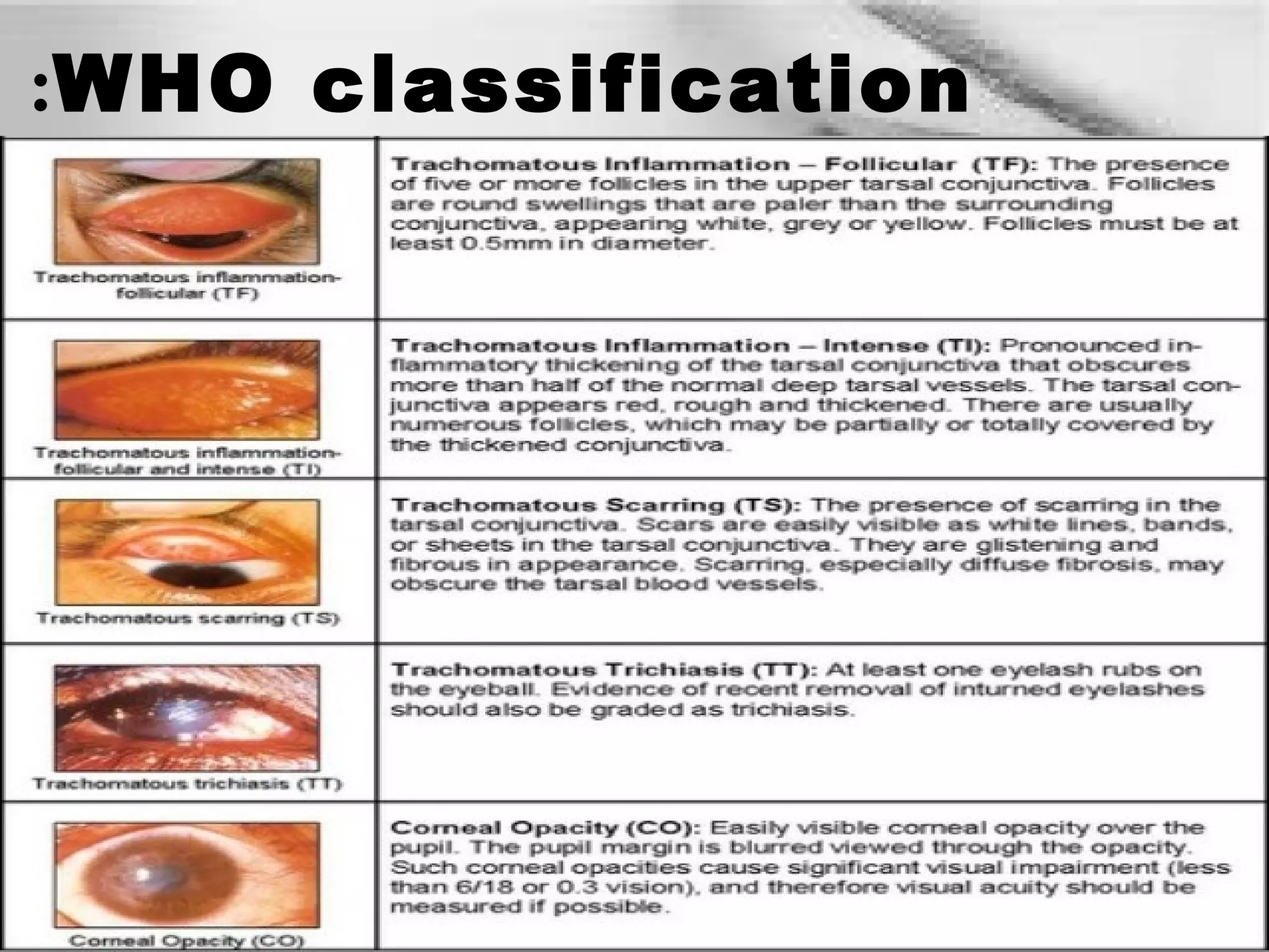 Chlamydia Conjunctivitis | PPT