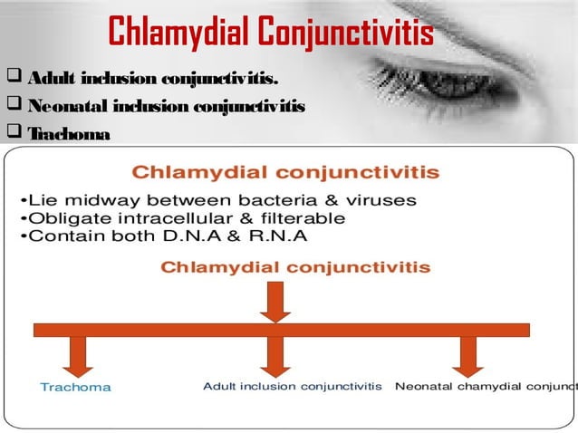 Chlamydia Conjunctivitis | PPT