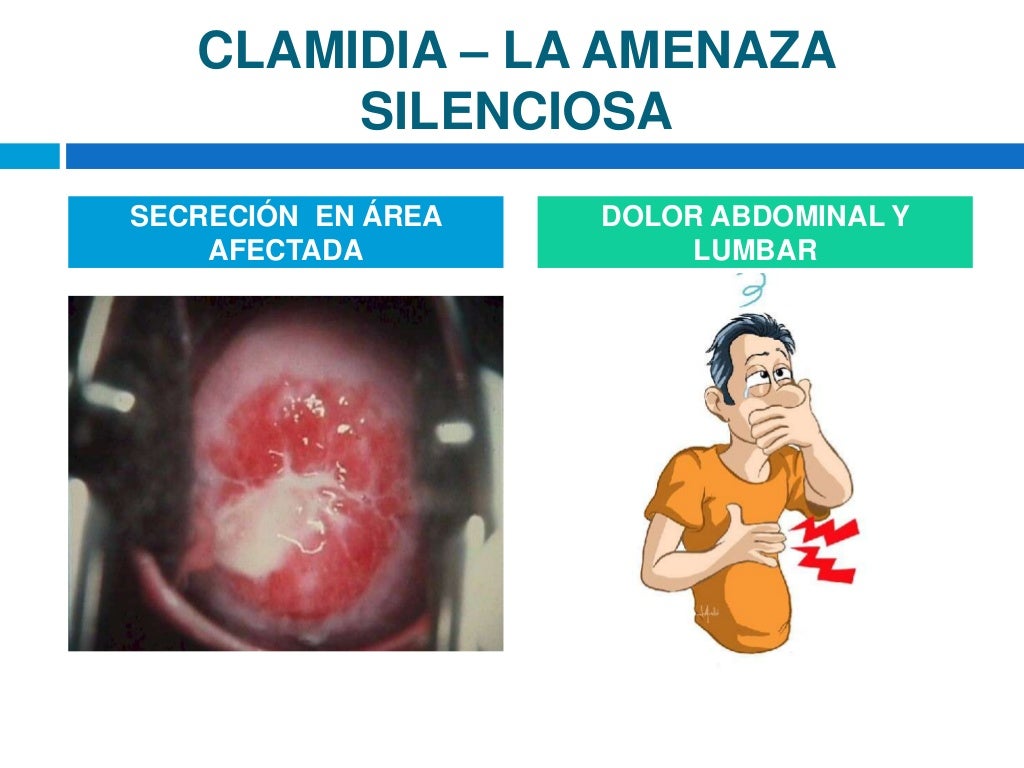 Chlamydia