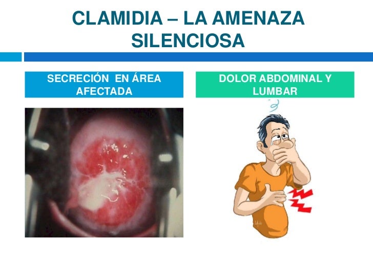Chlamydia