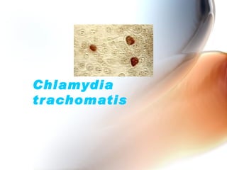 Chlamydia | PPT