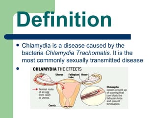 Chlamydia | PPT
