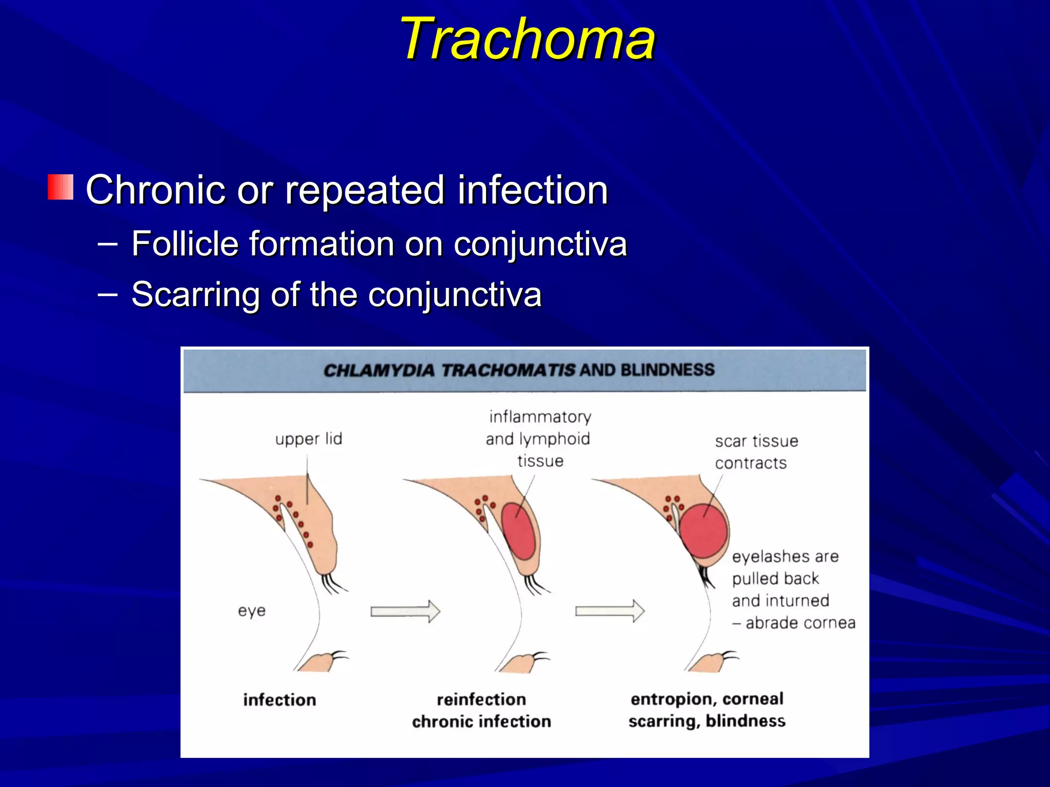 Chlamydia | PPT | Infectious Diseases | Diseases and Conditions