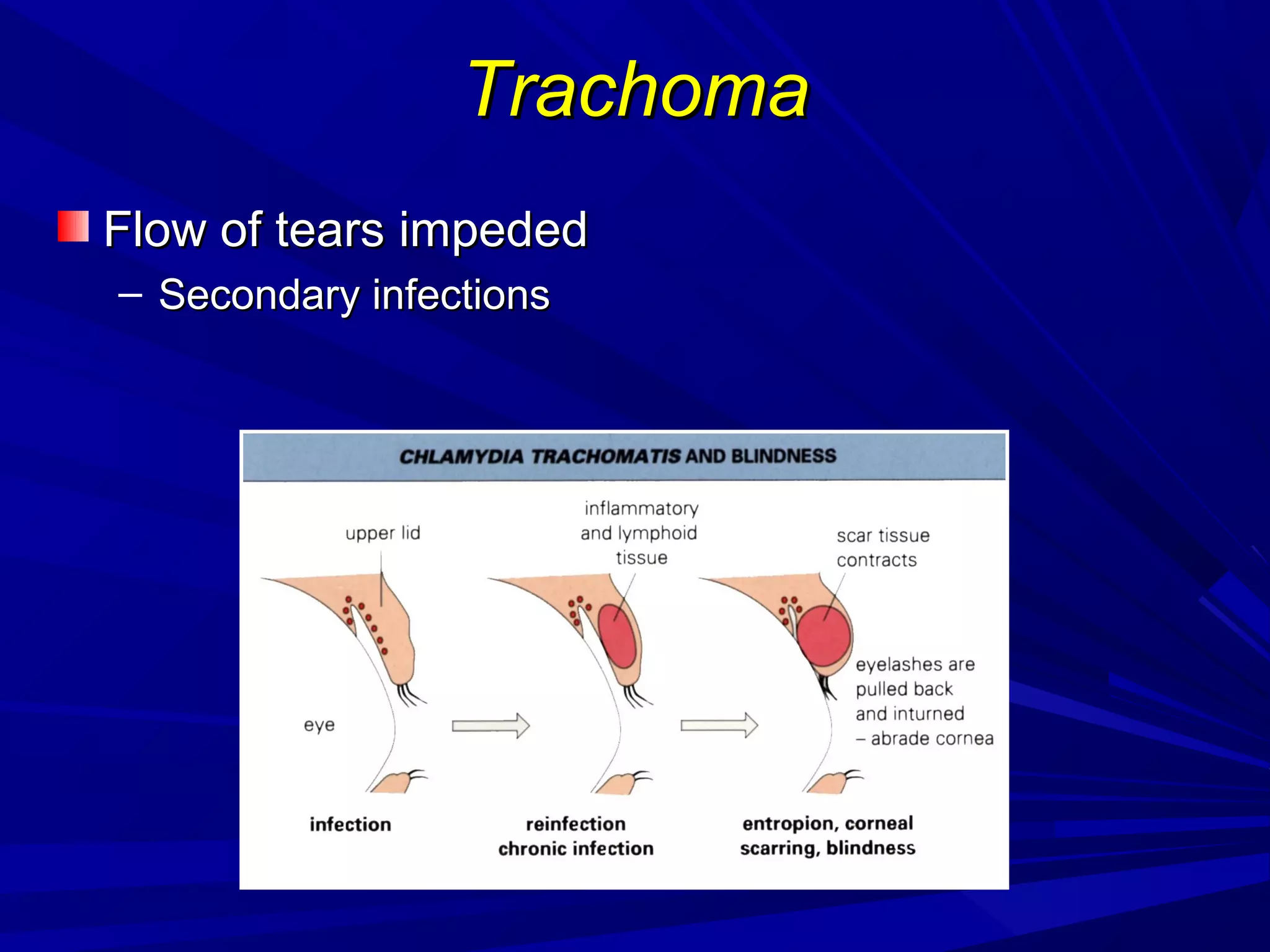 Chlamydia | PPT
