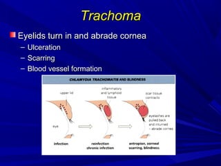Chlamydia | PPT