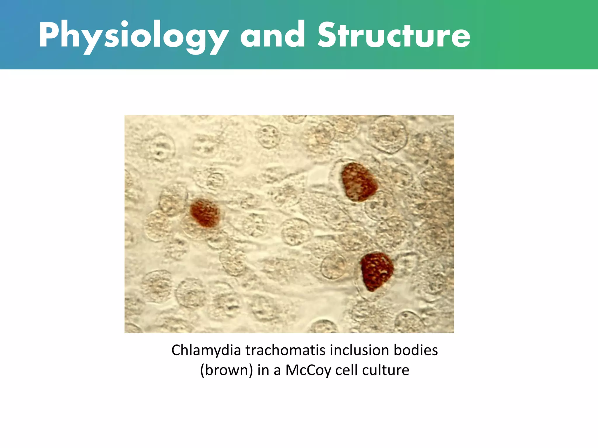 Chlamydia - The silent killer | PDF