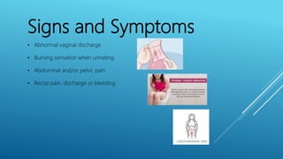 Chlamydia | PPTX