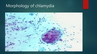 Chlamydia | PPT